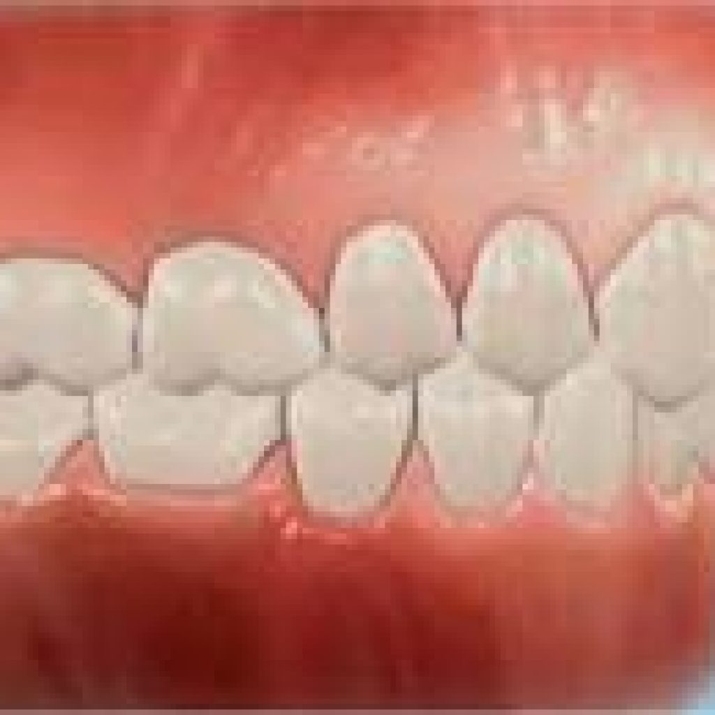 Orthodontic Treatment - Clear and Invisible Braces