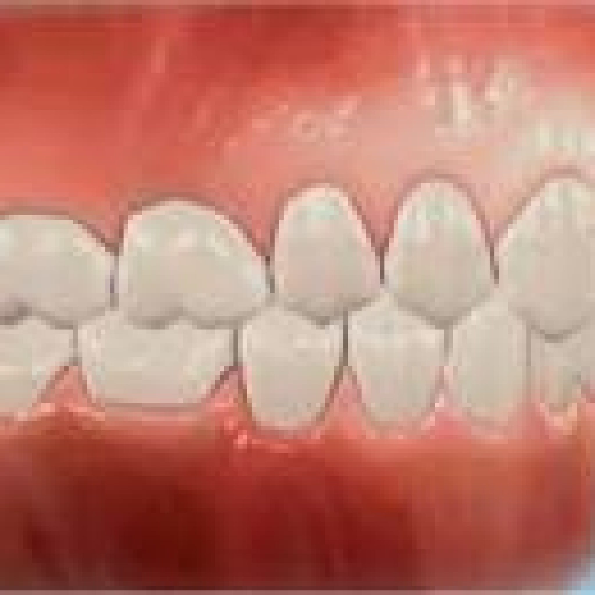 Orthodontic Treatment - Clear and Invisible Braces