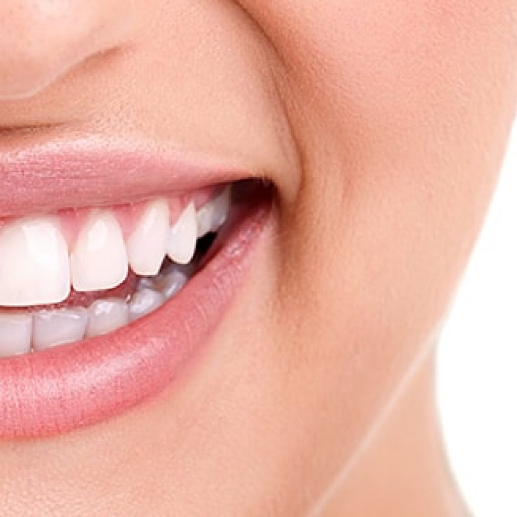 An Introduction To Invisalign In 5 Minutes - My Gentle Dentist