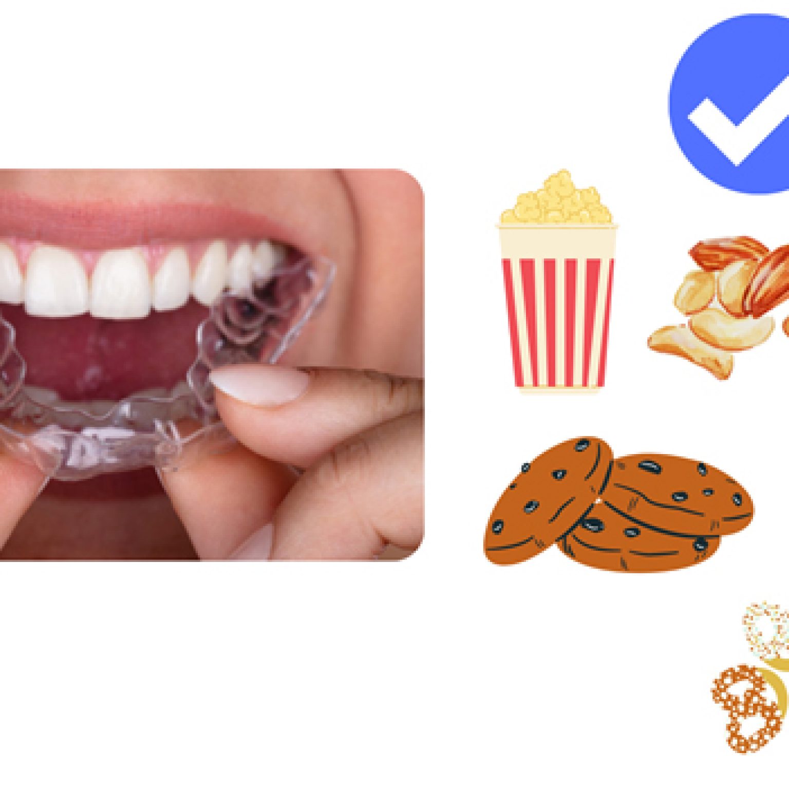 An Introduction To Invisalign In 5 Minutes - My Gentle Dentist