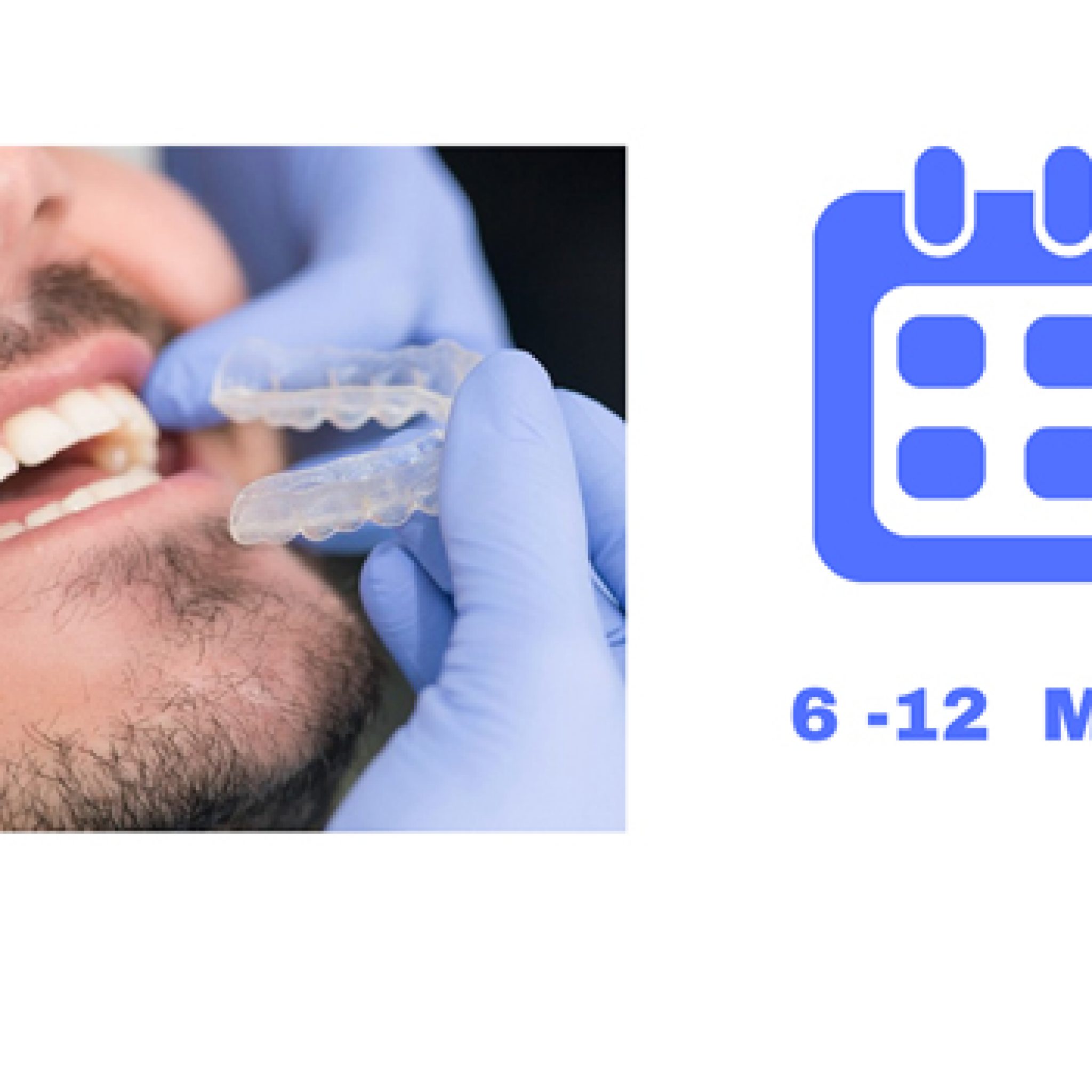 An Introduction To Invisalign In 5 Minutes - My Gentle Dentist