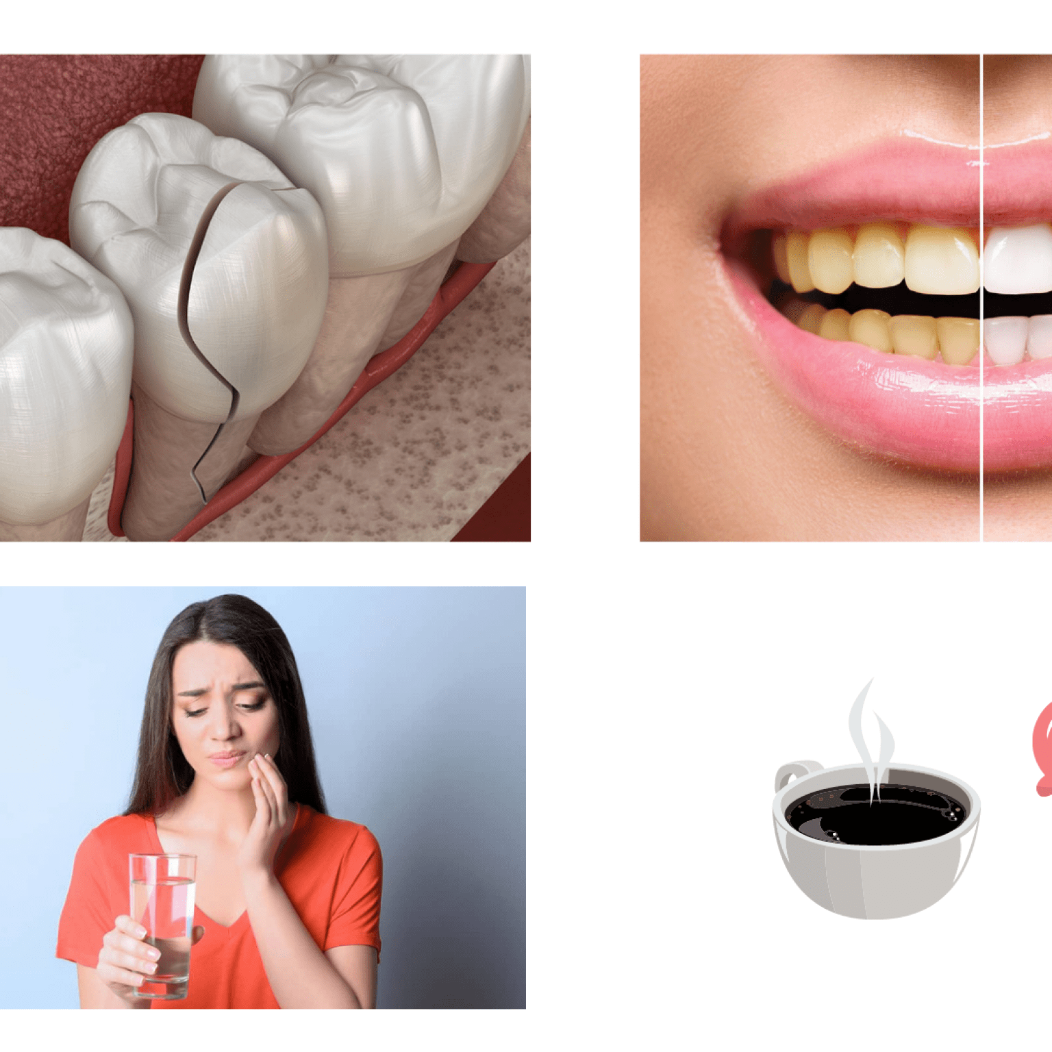 What Is Tooth Enamel Loss And How May It Be Treated