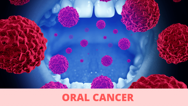 Oral Cancer: The Symptoms You Need to Know