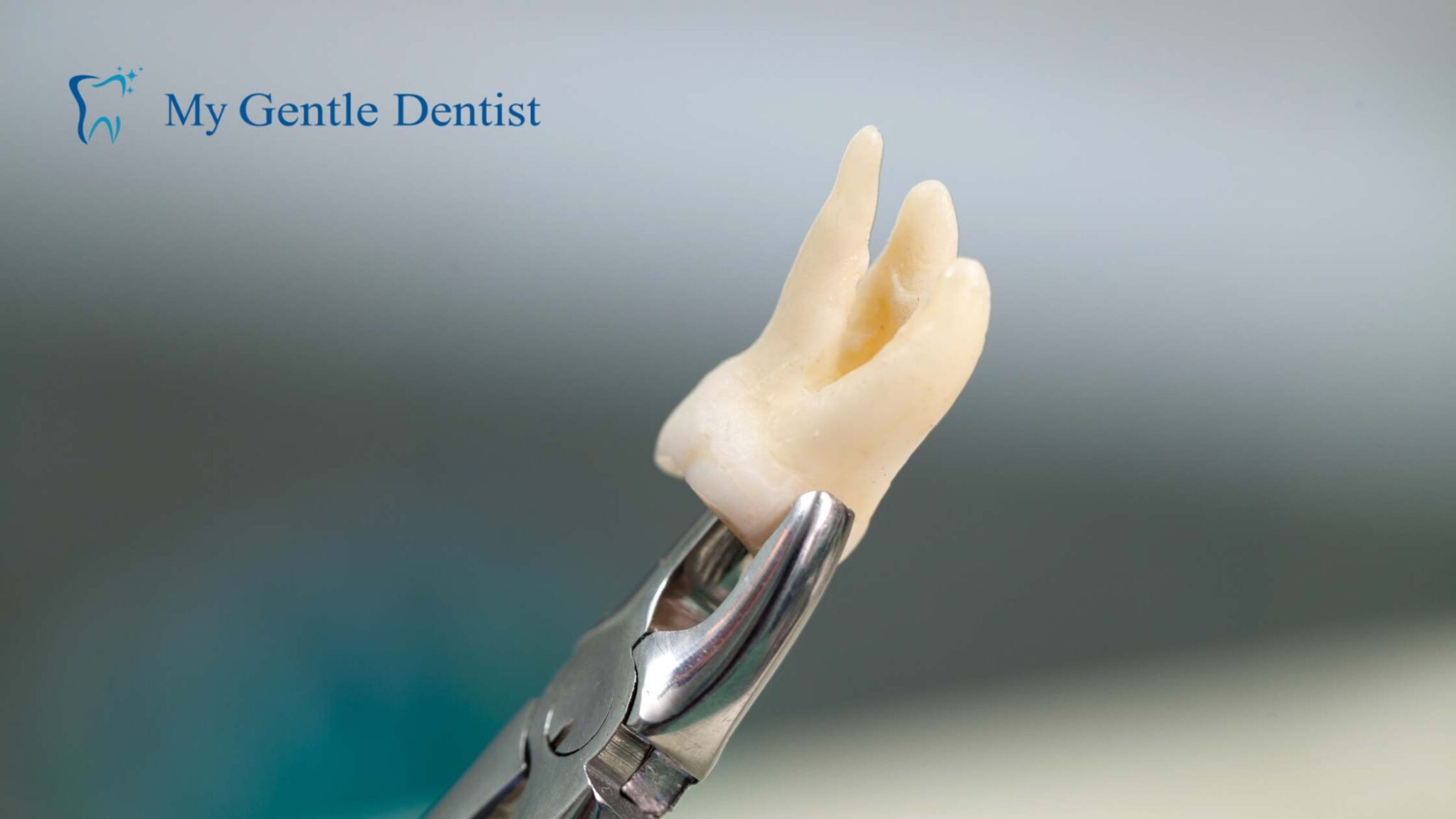 Wisdom Tooth Pain After Extraction: What’s Normal and What’s Not