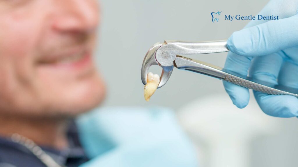 Is Tooth Extraction Cost Worth It? Key Points to Consider