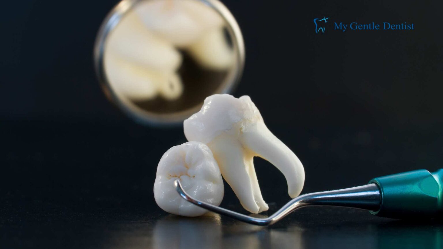 Is Tooth Extraction Cost Worth It? Key Points to Consider